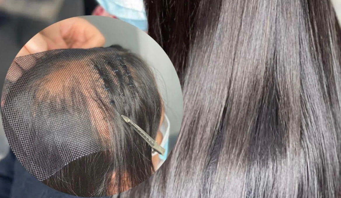 The House of Hair UK Hair Loss System – HouseofHairUK